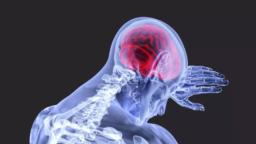 Šis smegenų implantas gali sustabdyti epilepsijos priepuolius, nes išskirdamas chemines medžiagas